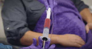 Administering a Secondary Infusion | EQUASHIELD Videos